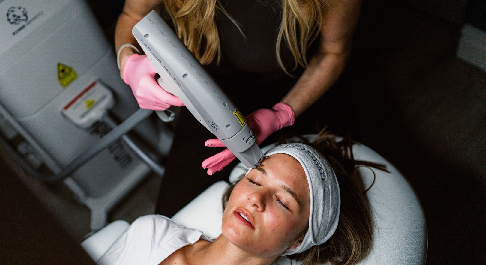 IPL Treatment Hinsdale | IPL Hinsdale | Unfiltered